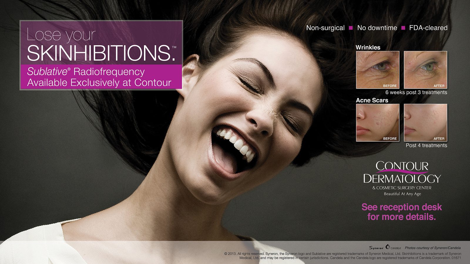 Sublative, Younger-Looking Skin | Contour Dermatology